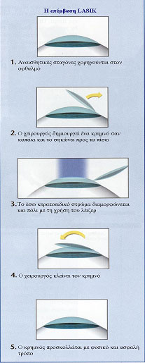 Διόρθωση Μυωπίας Υπερμετρωπίας και Αστιγματισμού με Laser - Ο Δρόμος ...